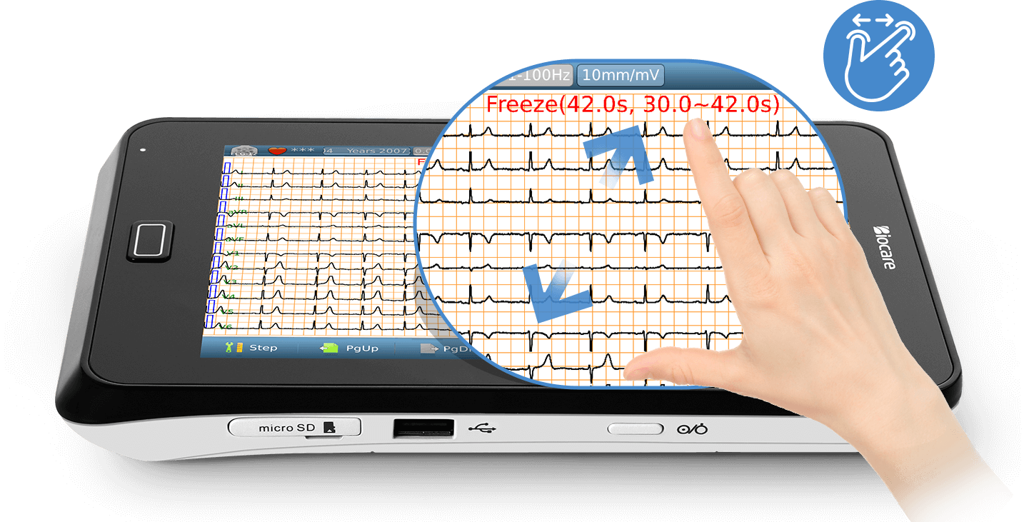 Point-of-Care 12-Lead ECG/EKG Machine Based on A Tablet, with Auto ...